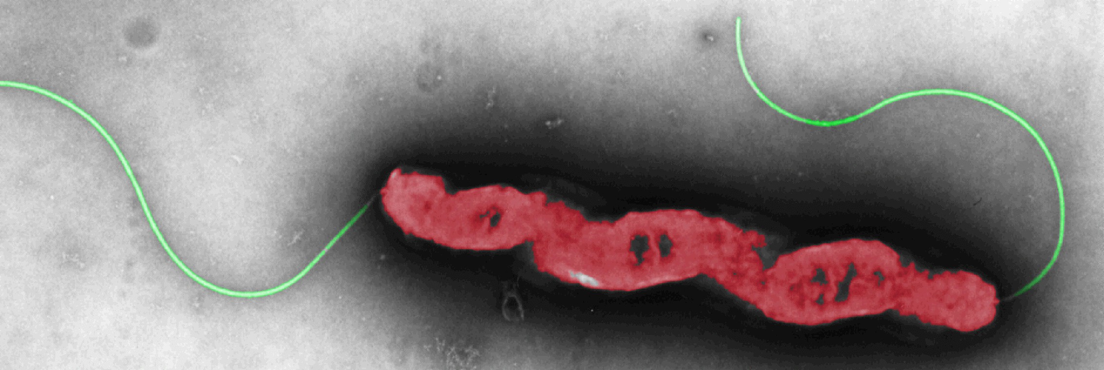 Campylobacter information site